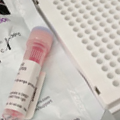 Differential scanning fluorimetry for PrP: an assay development saga